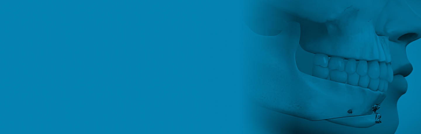 Corrective Jaw Surgery CA - Beverly Hills Oral & Facial Surgeon Corrective Jaw Surgery CA - Beverly Hills Oral & Facial Surgeon